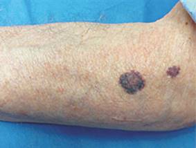 Dermatología geriátrica