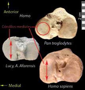 El dilema obstétrico