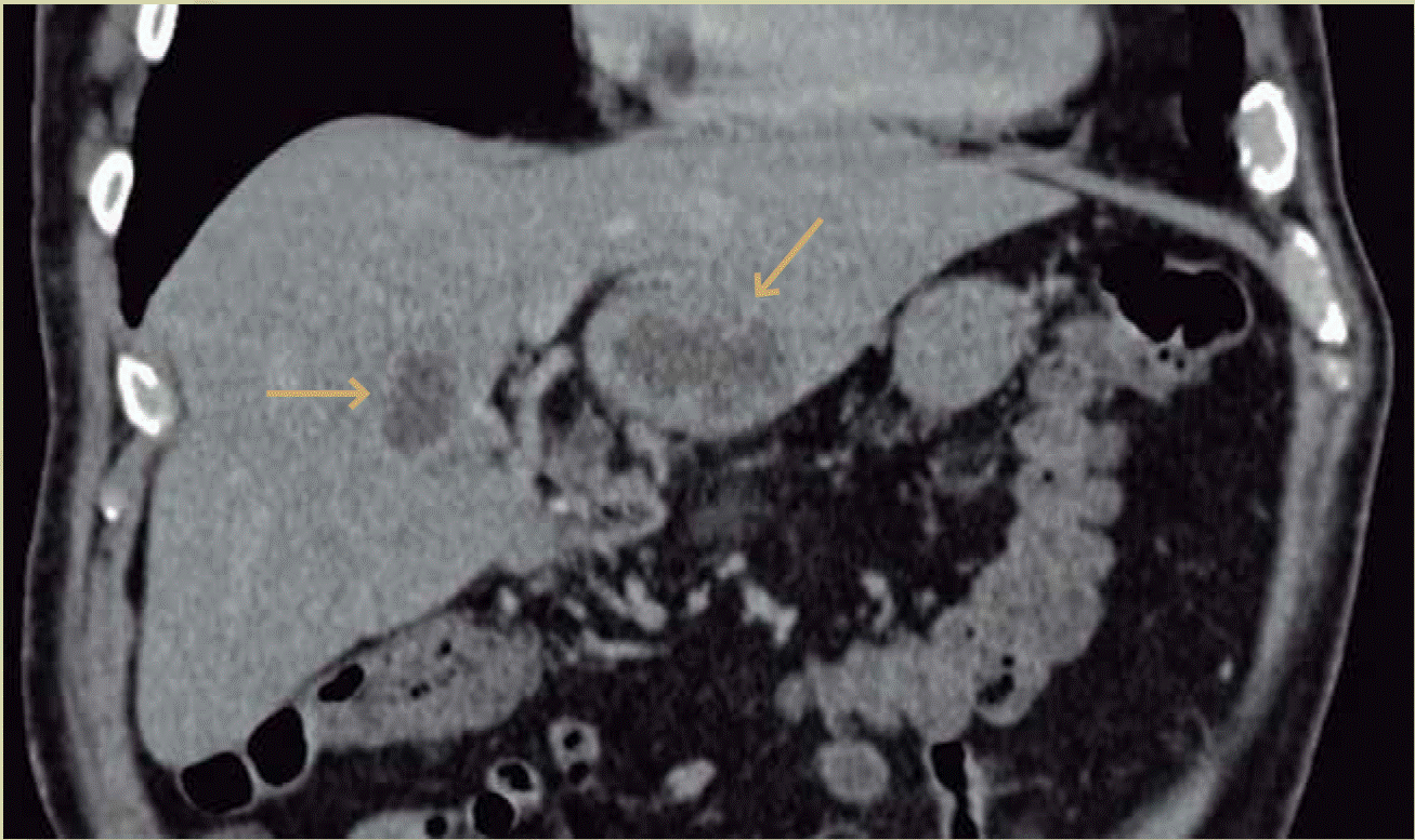 Haga su diagnóstico