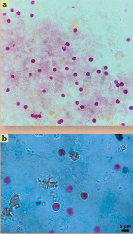 El ciclo biológico de los coccidios intestinales y su aplicación clínica