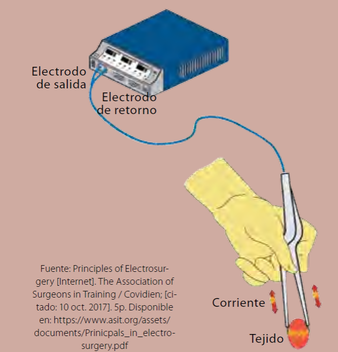 Quemadura secundaria a incorrecta colocación de placa de electrocauterio