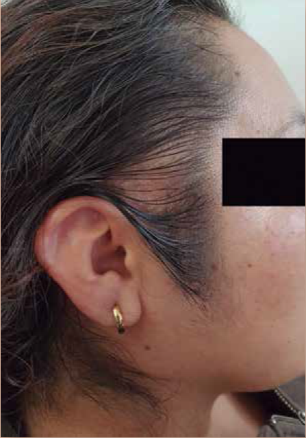 El pelo: generalidades y enfermedades más comunes