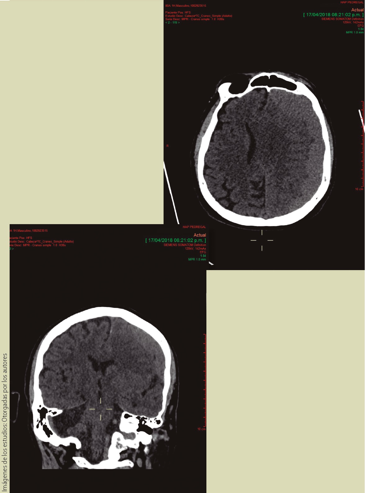 Haga su diagnóstico