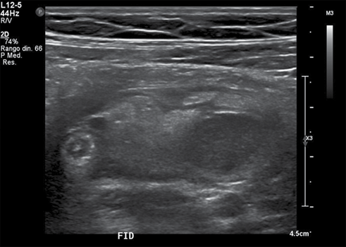 Haga su diagnóstico