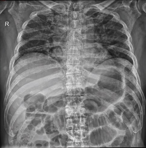 Haga su diagnóstico