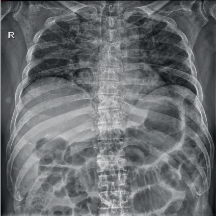 Haga su diagnóstico