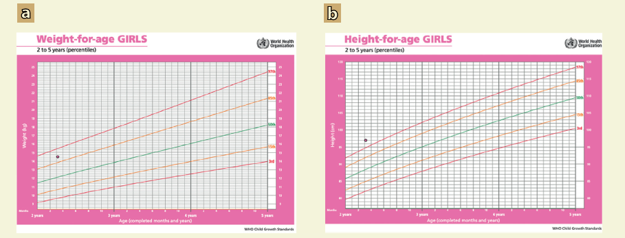 Hernia diafragmática congénita de presentación tardía Reporte de caso ...