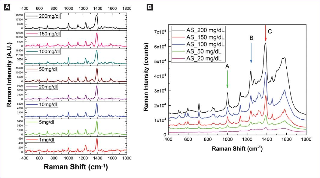 Evaluation of sialic acid concentrations and its association with the ...