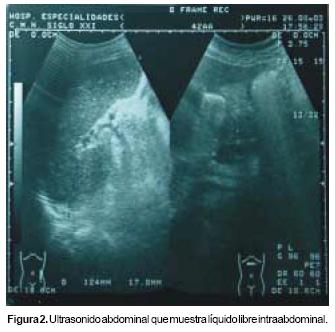 Mujer de 42 años con ascitis y presencia de linfadenopatía generalizada