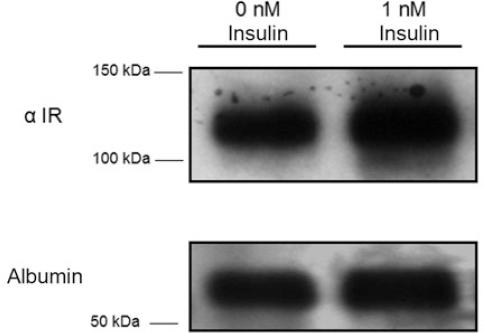 Soluble insulin receptor and metabolic syndrome