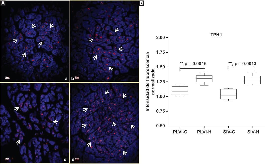 La miocardiopatía hipertrófica induce cambios en la expresión de la ...