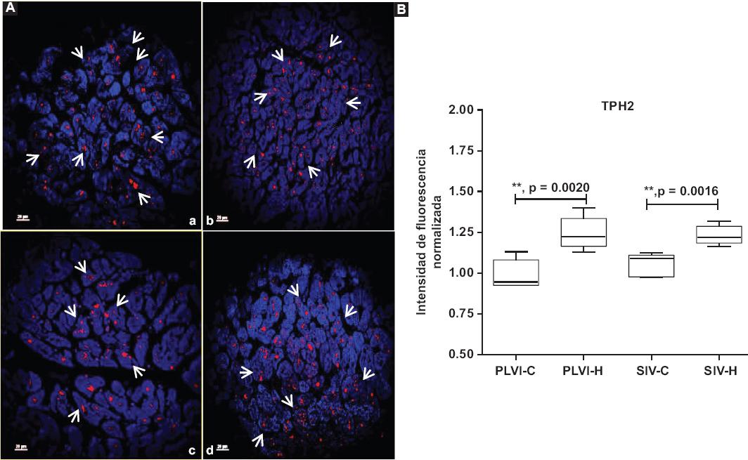 La miocardiopatía hipertrófica induce cambios en la expresión de la ...