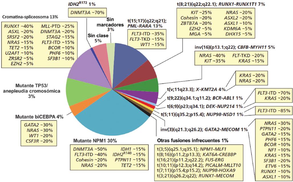 Consenso de leucemia mieloide aguda en México