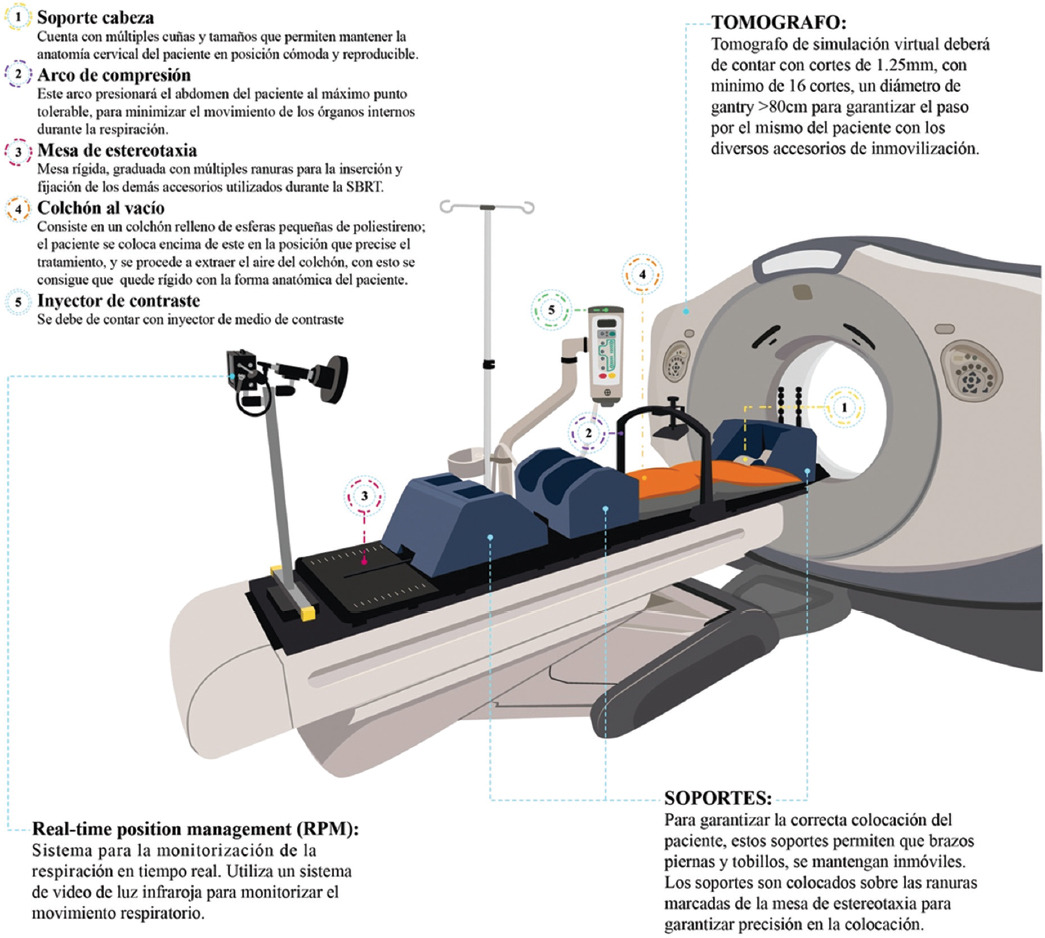 Usos y aplicaciones actuales de la radioterapia corporal estereotáctica