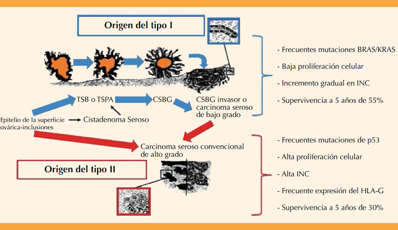 Carcinogénesis De Los Tumores Serosos Del Ovario Implicaciones