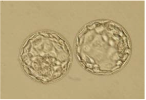 Resultados de un programa de reproducción asistida con transferencia de ...