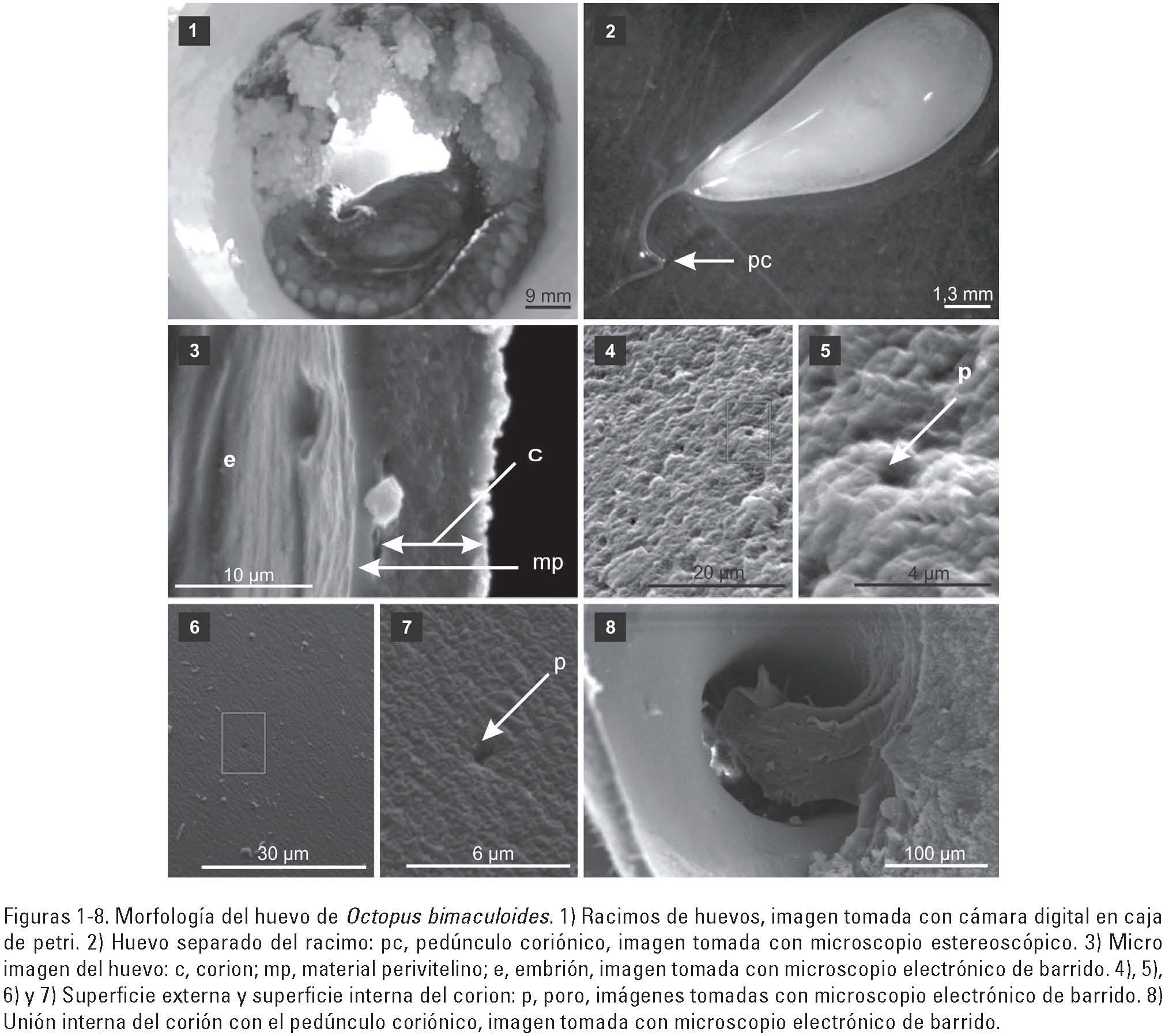 Morfología de la membrana coriónica de los huevos de Octopus ...