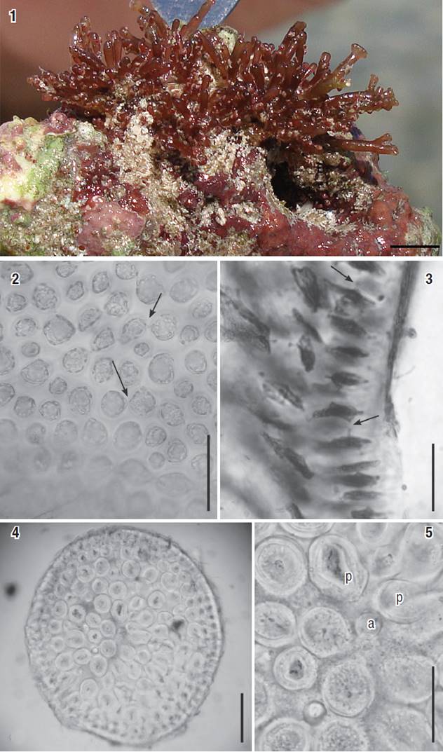 Morphological and molecular evidence for Osmundea coelenterata comb ...