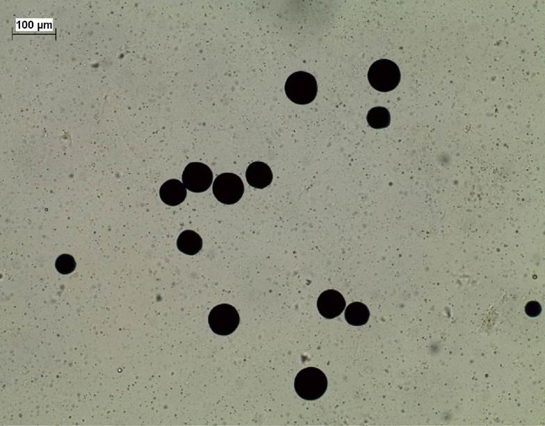 Detección de Perkinsus marinus en una población silvestre del mejillón ...