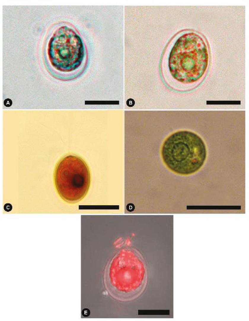 Morphochemical characterization of Chlamydomonas during its blooming in ...