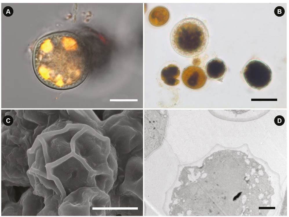 Morphochemical characterization of Chlamydomonas during its blooming in ...