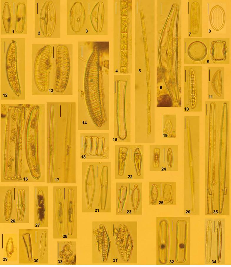 Microalgas asociadas a un vertedero de la Planta de Tratamiento de ...