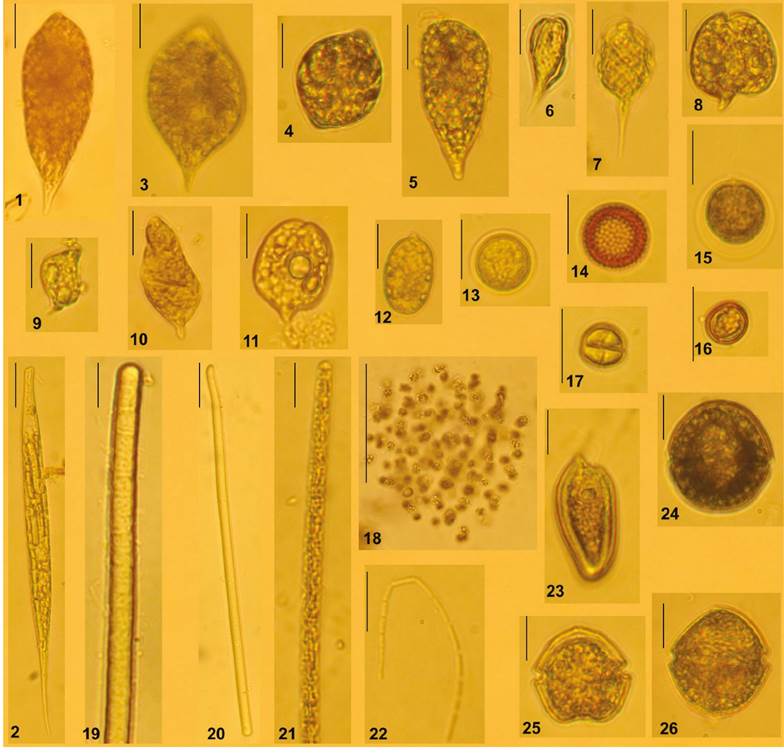 Microalgas asociadas a un vertedero de la Planta de Tratamiento de ...