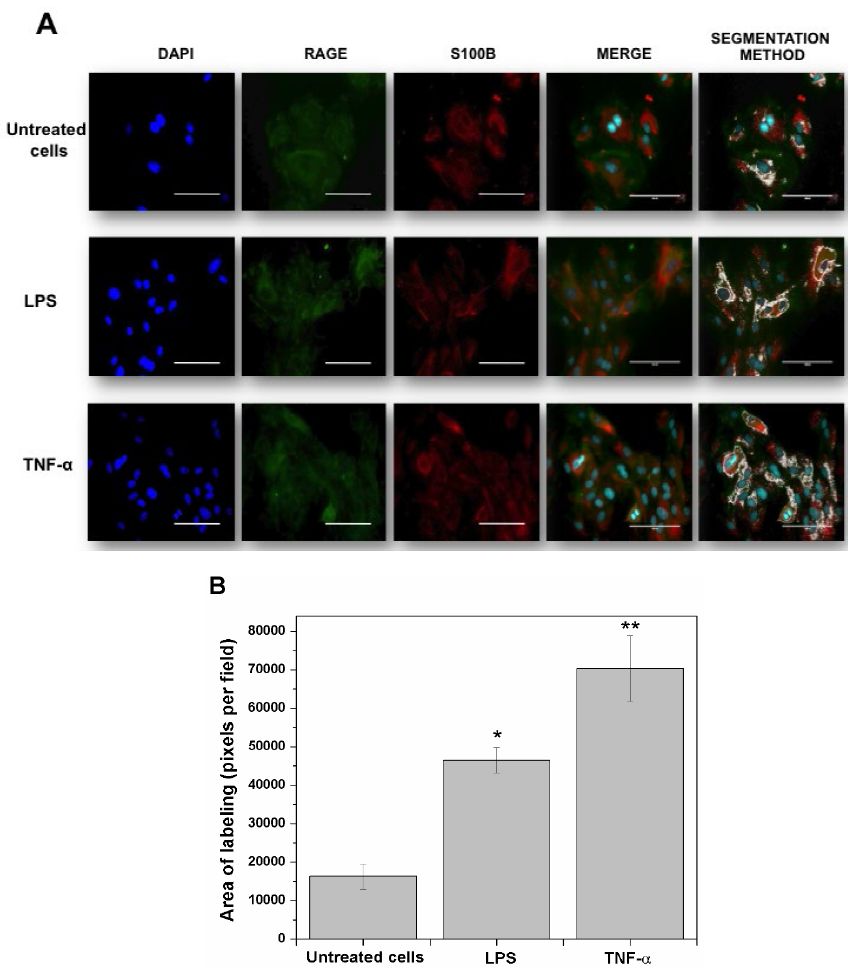 Co-localization of the Receptor for Advanced Glycation End Products ...