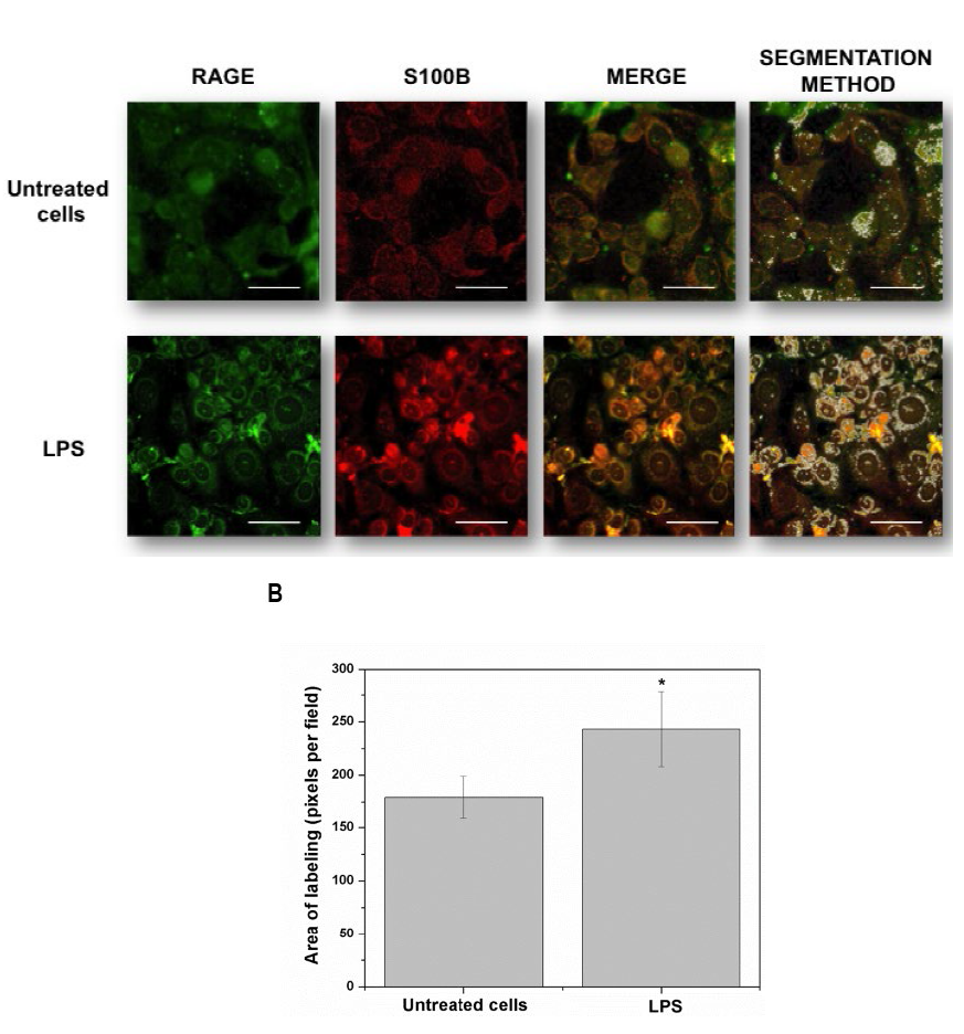 Co-localization of the Receptor for Advanced Glycation End Products ...