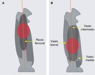 Relación entre la medición sonográfica de los músculos recto femoral y ...