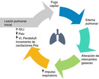 Lesión pulmonar autoinflingida por el paciente en la Unidad de Cuidados ...