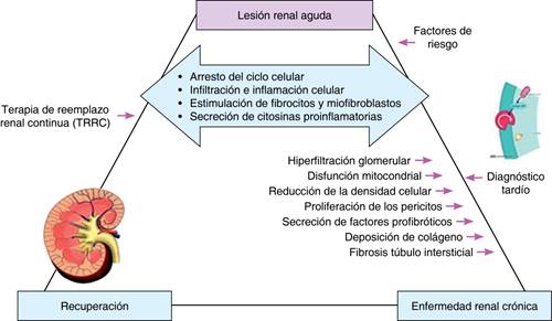 Evolución de pacientes con lesión renal aguda secundaria a ...