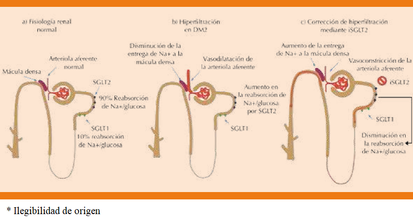 iSGLT2 y su potencial efecto nefroprotector en pacientes con diabetes ...