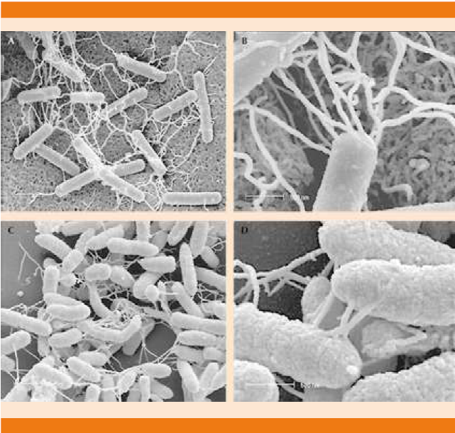 Mionecrosis fulminante metastásica por Aeromonas caviae
