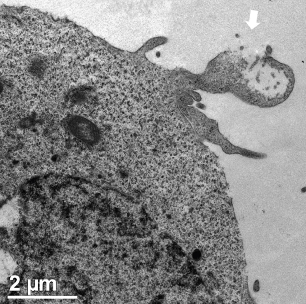 Lipid bilayer-coated nanoparticles: mimetism for biomedical applications