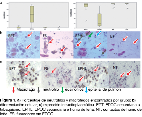 Resúmenes de los Trabajos Libres del LXXIII Congreso de Neumología y ...