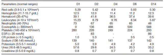Chronic cough, wheezing and dyspnea: bronchiectasis and aspergillosis
