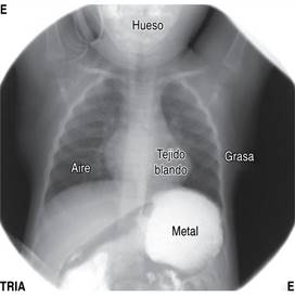 Radiografía De Pulmones Sanos