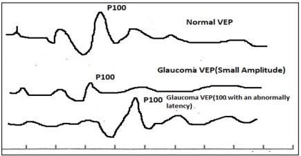 Evaluation of Filtering Techniques applied to simulated ...