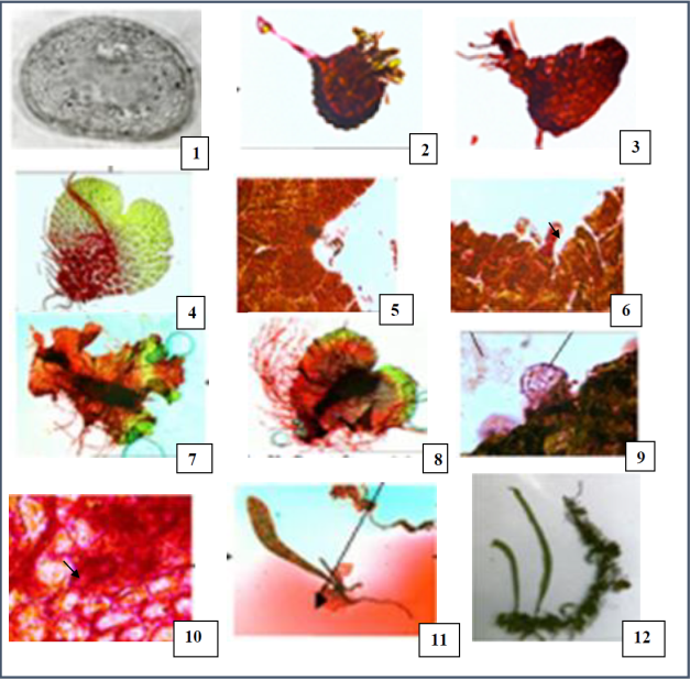 Descripción morfogénica de gametófitos y esporófitos jóvenes de ...
