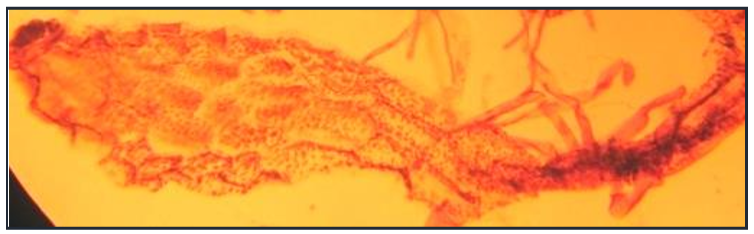 Descripción del desarrollo morfogénico de los prótalos y esporófitos ...