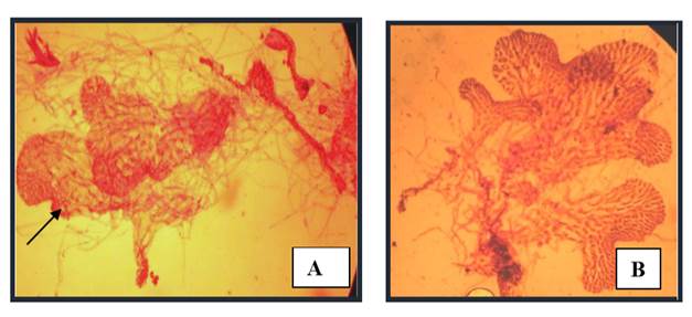 Descripción del desarrollo morfogénico de los prótalos y esporófitos ...