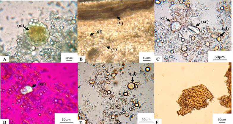Caracterización micrográfica de tres frutos tropicales, Musa paradisii ...