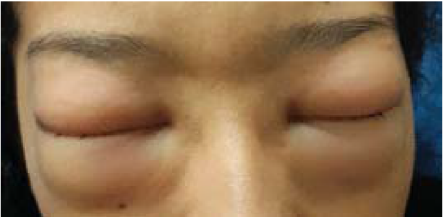 ¿Son seguros los productos naturales analgésicos en los pacientes con ...