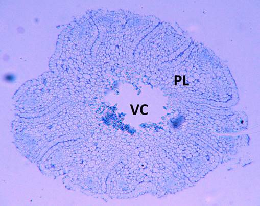 Morphoanatomy of Acrocomia aculeata (Jacq.) Lodd. ex Mart. (Arecaceae ...