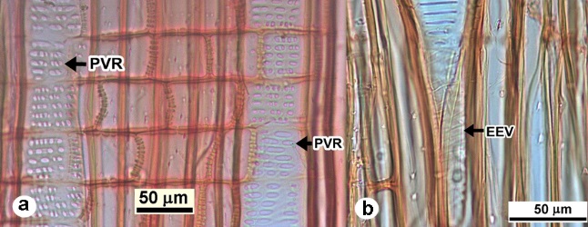 Wood anatomy of Magnolia rzedowskiana Vázquez, Domínguez & Pedraza ...