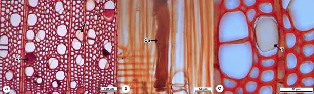 Wood anatomy of Magnolia rzedowskiana Vázquez, Domínguez & Pedraza ...