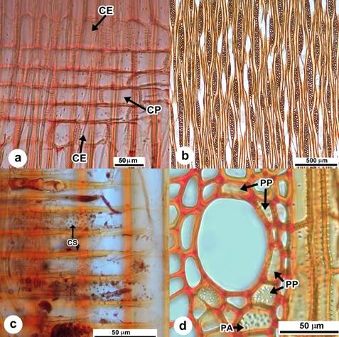Wood anatomy of Magnolia rzedowskiana Vázquez, Domínguez & Pedraza ...