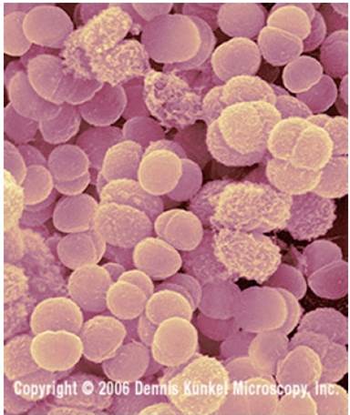 Origen y mecanismos de la radio-resistencia en Deinococcus radiodurans