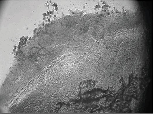 Biocontrol in vitro de Uromyces transversalis (Thümen) G. Winter ...